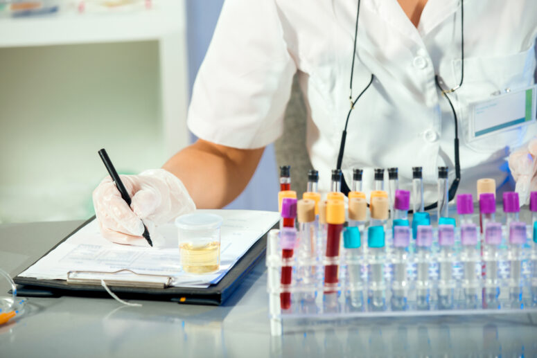 EtG Testing – Know the Facts - SCRAM Systems of Illinois